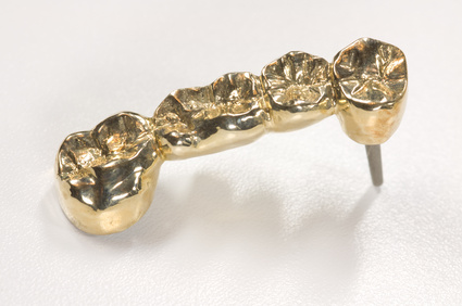 Zahngold Ankauf - Goldstübchen